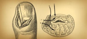 Qu’est ce qu’un panari ? – panari.fr