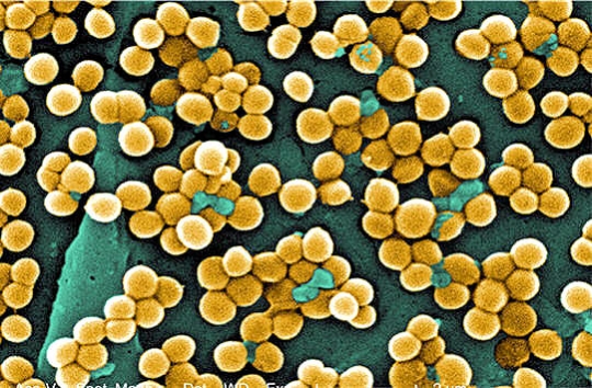 Qu’est ce qu’un panari ? – panari.fr